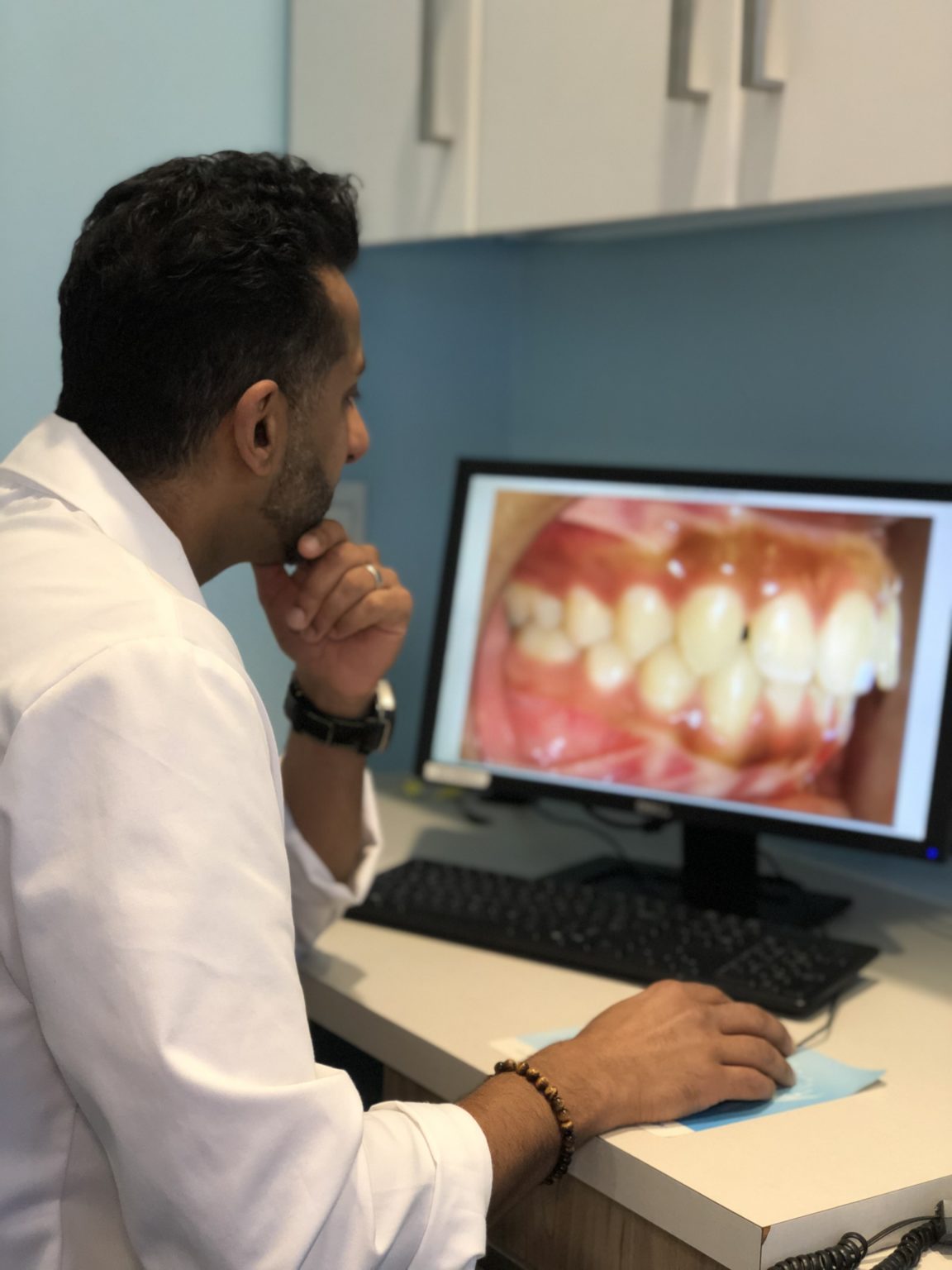 How do Braces Work to Straighten Teeth? | Aura Orthodontics